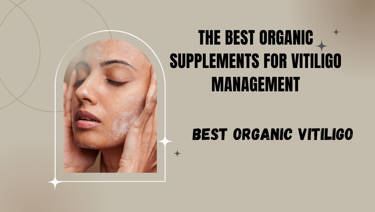 Best Organic Vitiligo Supplements | Vitiligo Organics